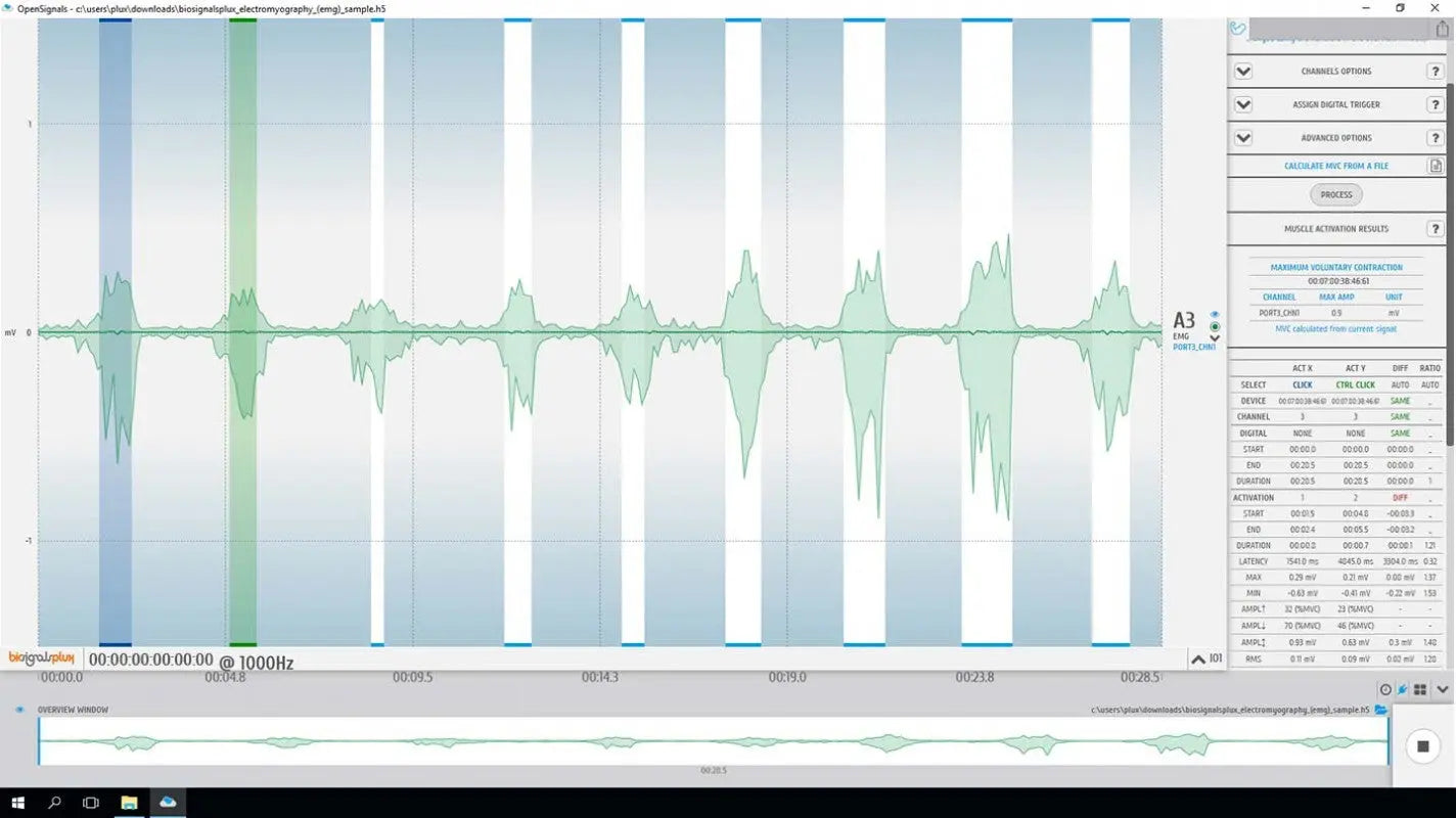 PLUX Biosignals | Electromyography (EMG) Analysis Add-on